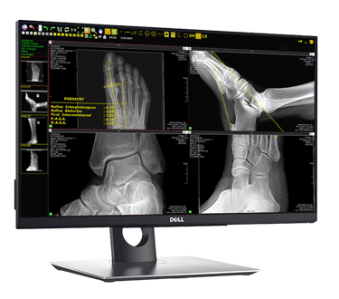 10 Ways X-rays are Used in Podiatry