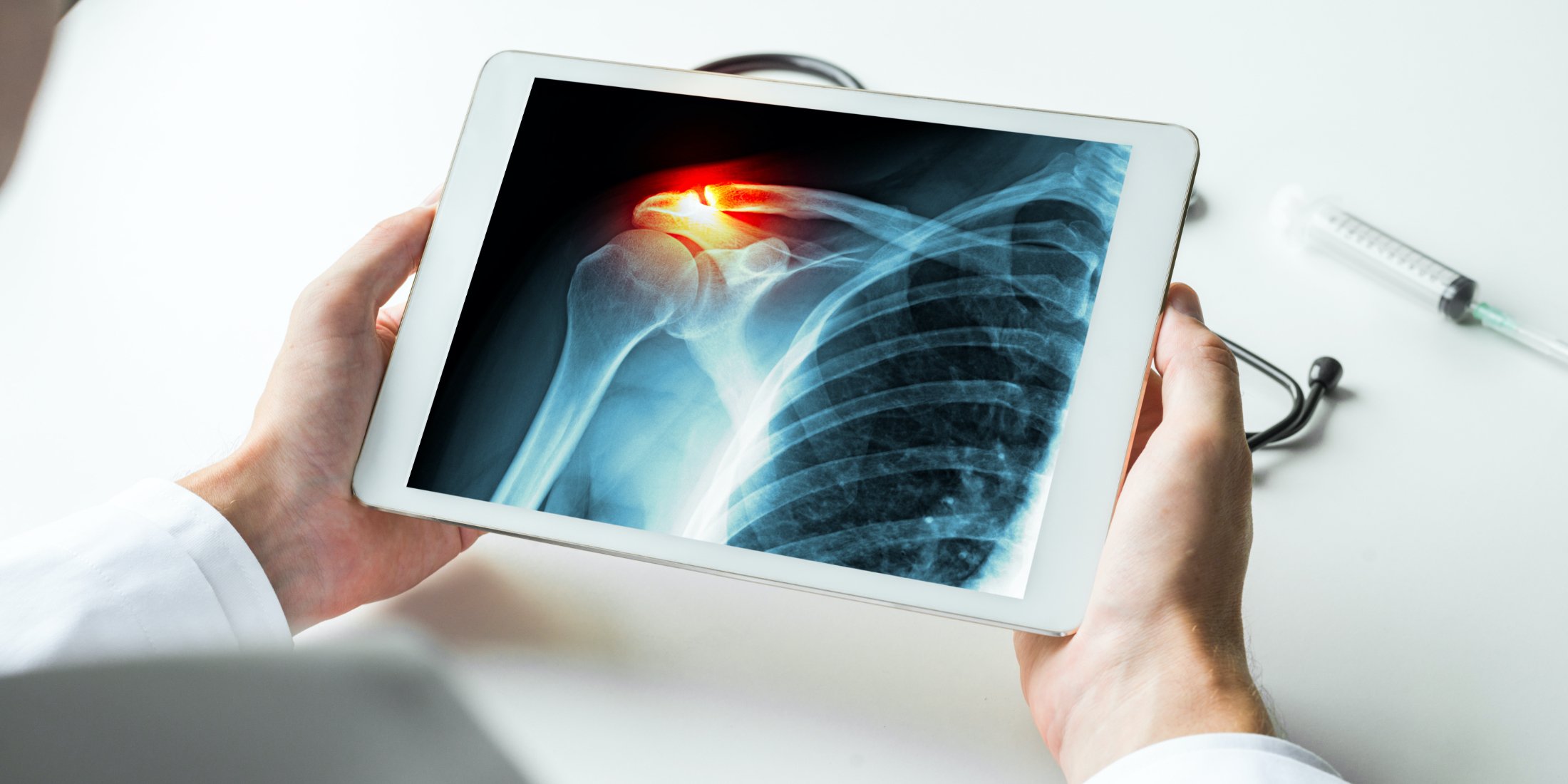 8 Reasons to Integrate Digital X-rays into Your Practice