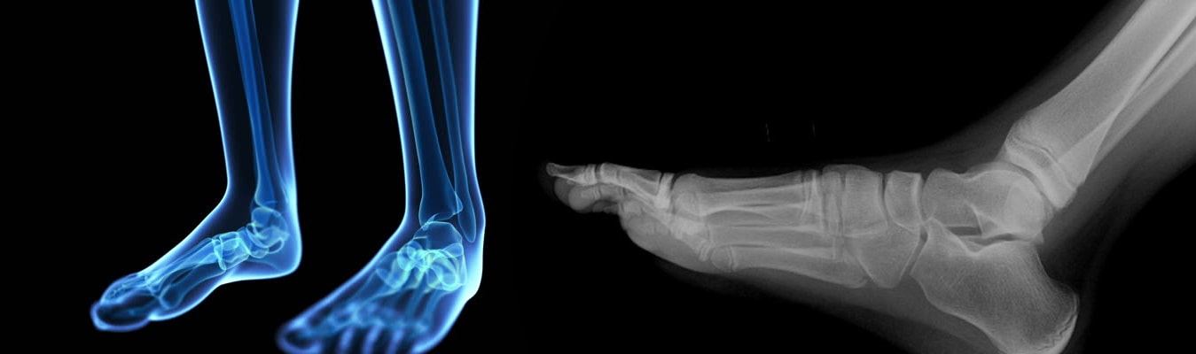 10 Ways X-rays are Used in Podiatry