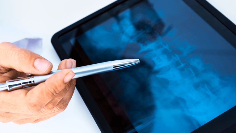 Chiropractic Body Works - Chiropractic X-ray Case Study
