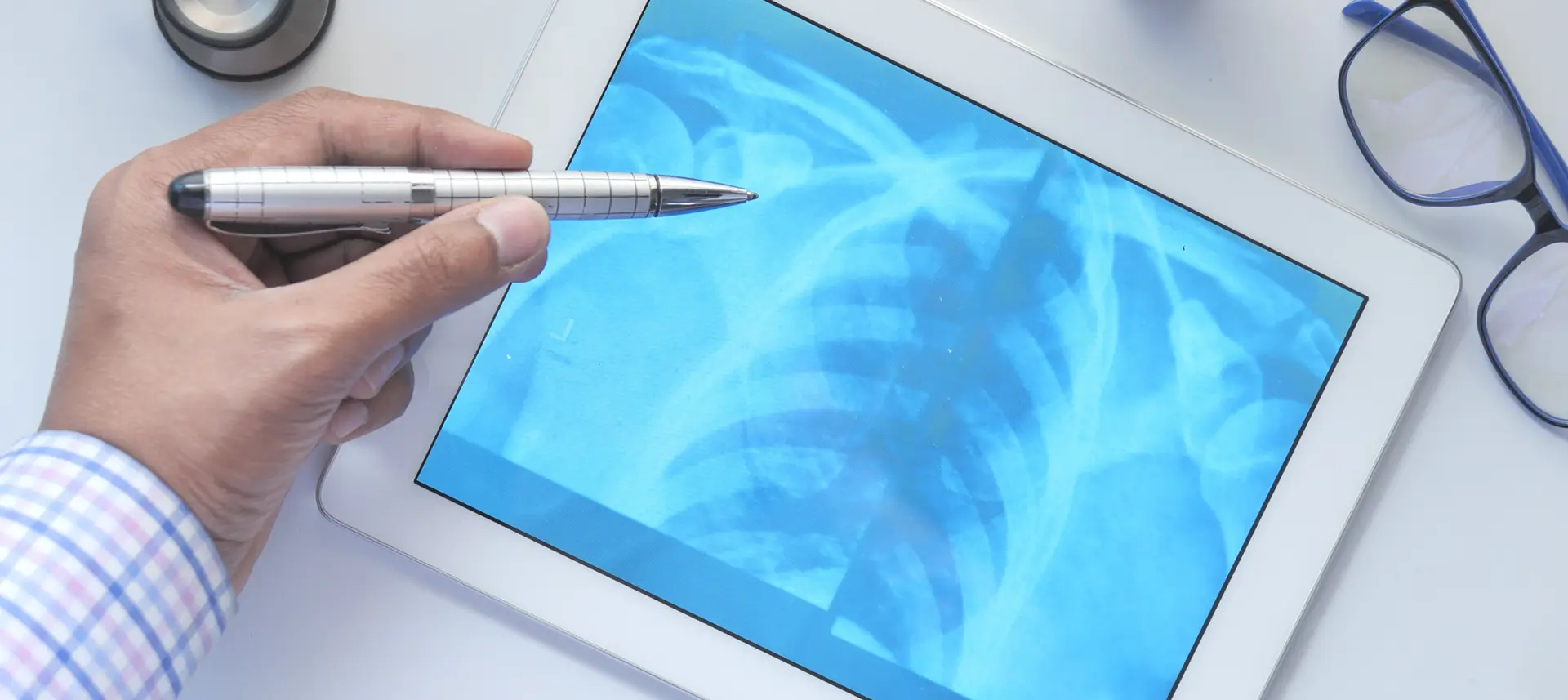 Digital Radiography (DR) vs. Computed Radiography (CR) Systems