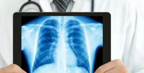 25 Common Radiology Terms