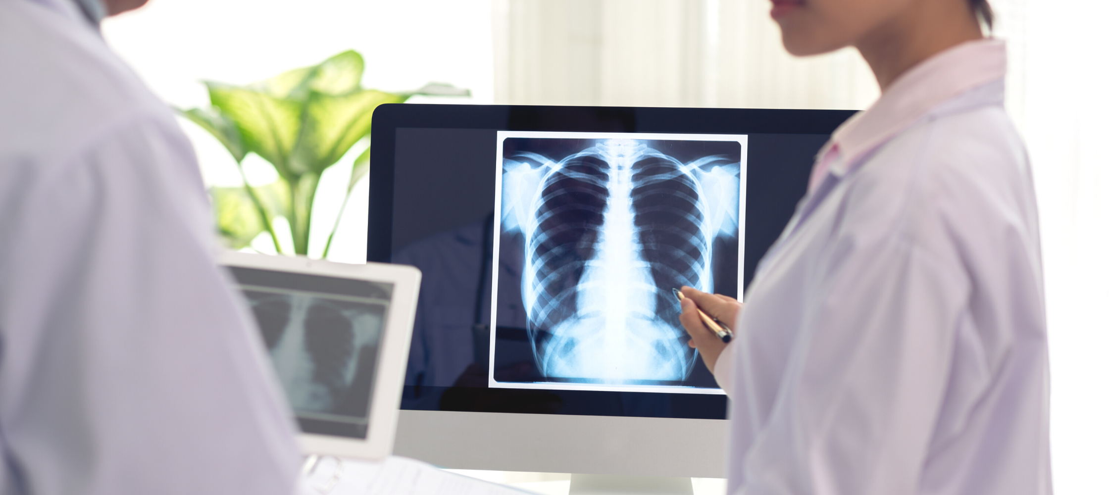 Mobile X-Ray Systems: Pros, Cons, and Costs
