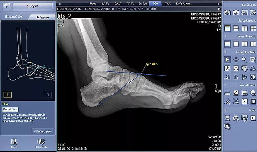 Orthopedic X-Ray Interpretation